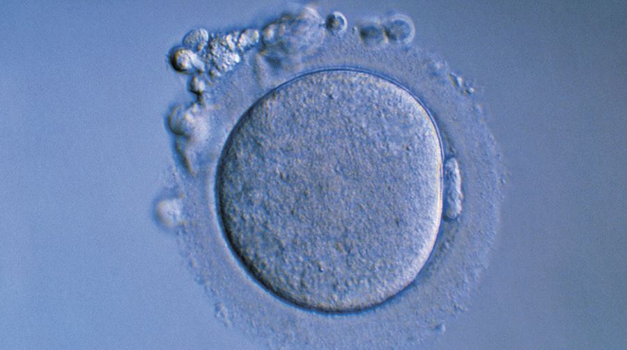 Zanimivost: Celice se med seboj razlikujejo